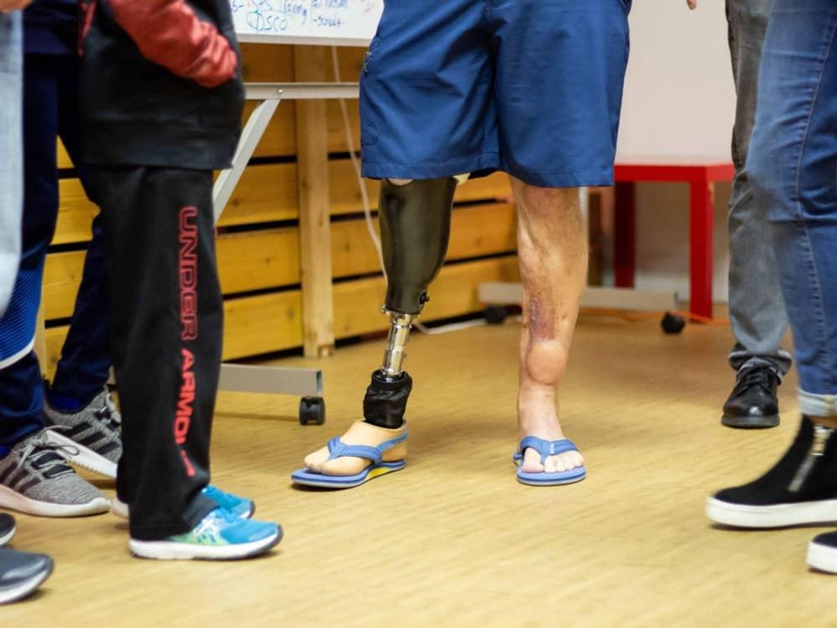 The innovative sandals give amputees the chance to wear flip-flops ...